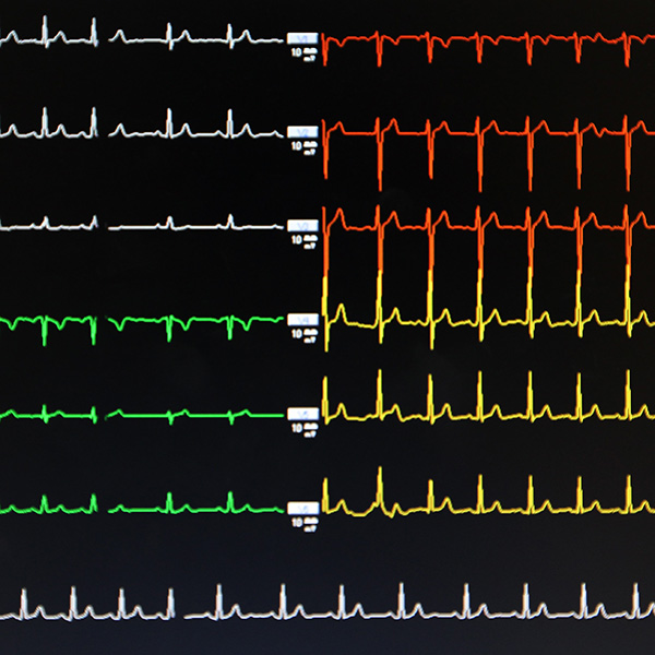 Exames – CDC Cárdio
